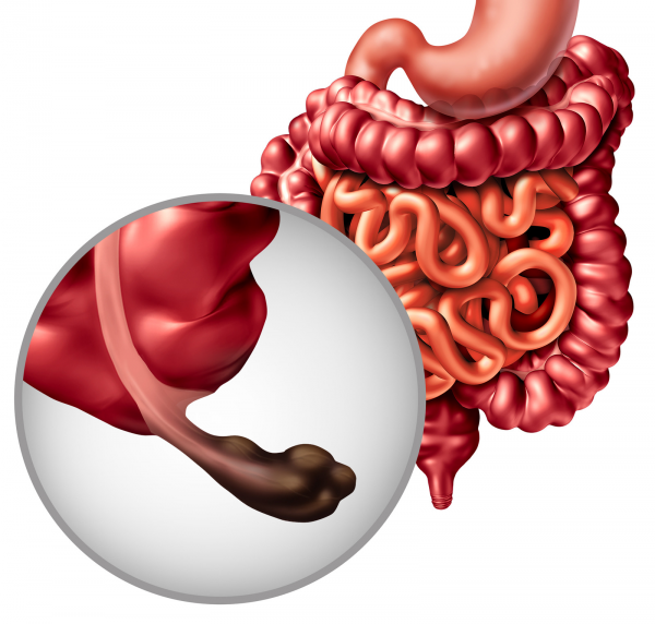 Basics techniques needed to evaluate the Appendix! – Integrated ...